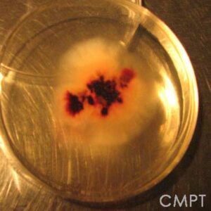 Trichophyton_violaceum_reverse_sab_OPT | cmpt